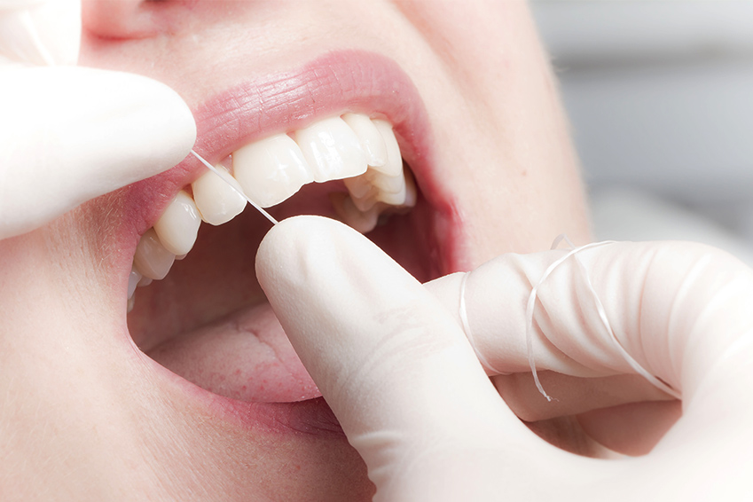 Zahnseide - Warum die Verwendung wichtig ist - Zahnarzt Budde ...